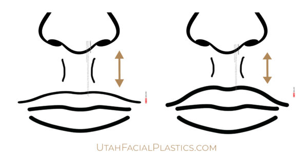 Lip Lift Procedure | Utah Facial Plastics | Salt Lake City, UT