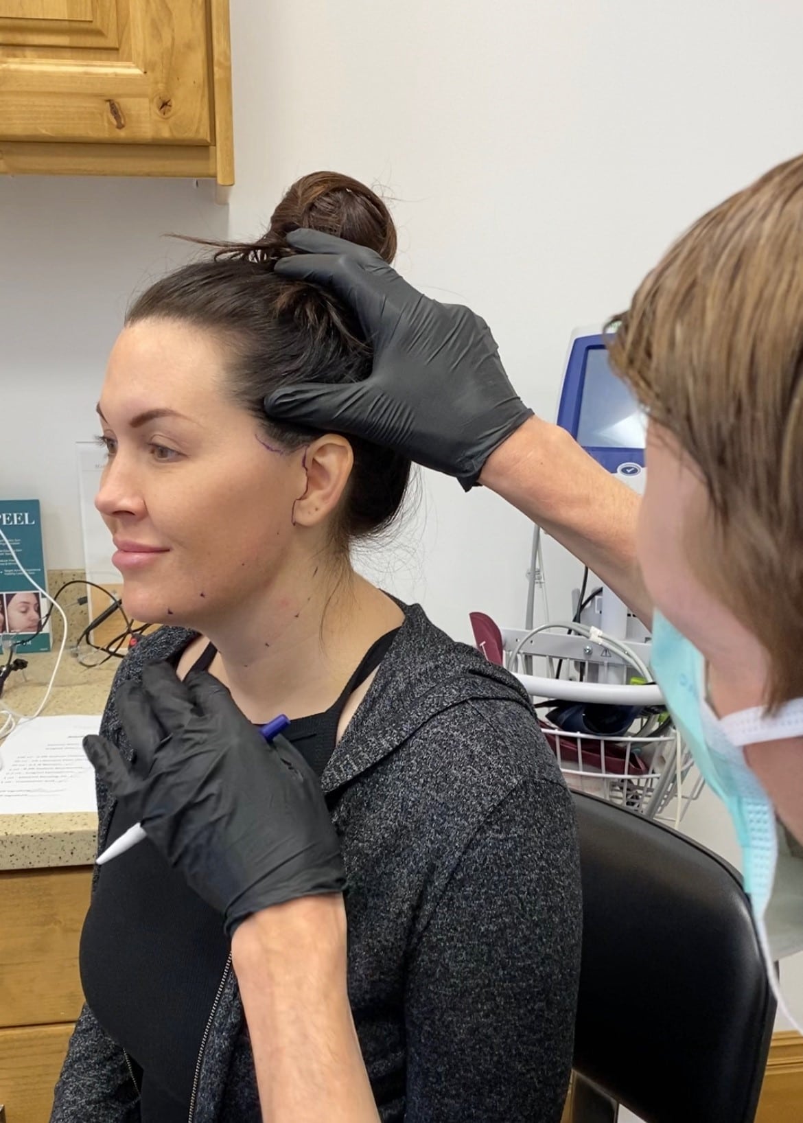 Lo que un mini lifting facial puede y no puede hacer - Utah Facial Plastics