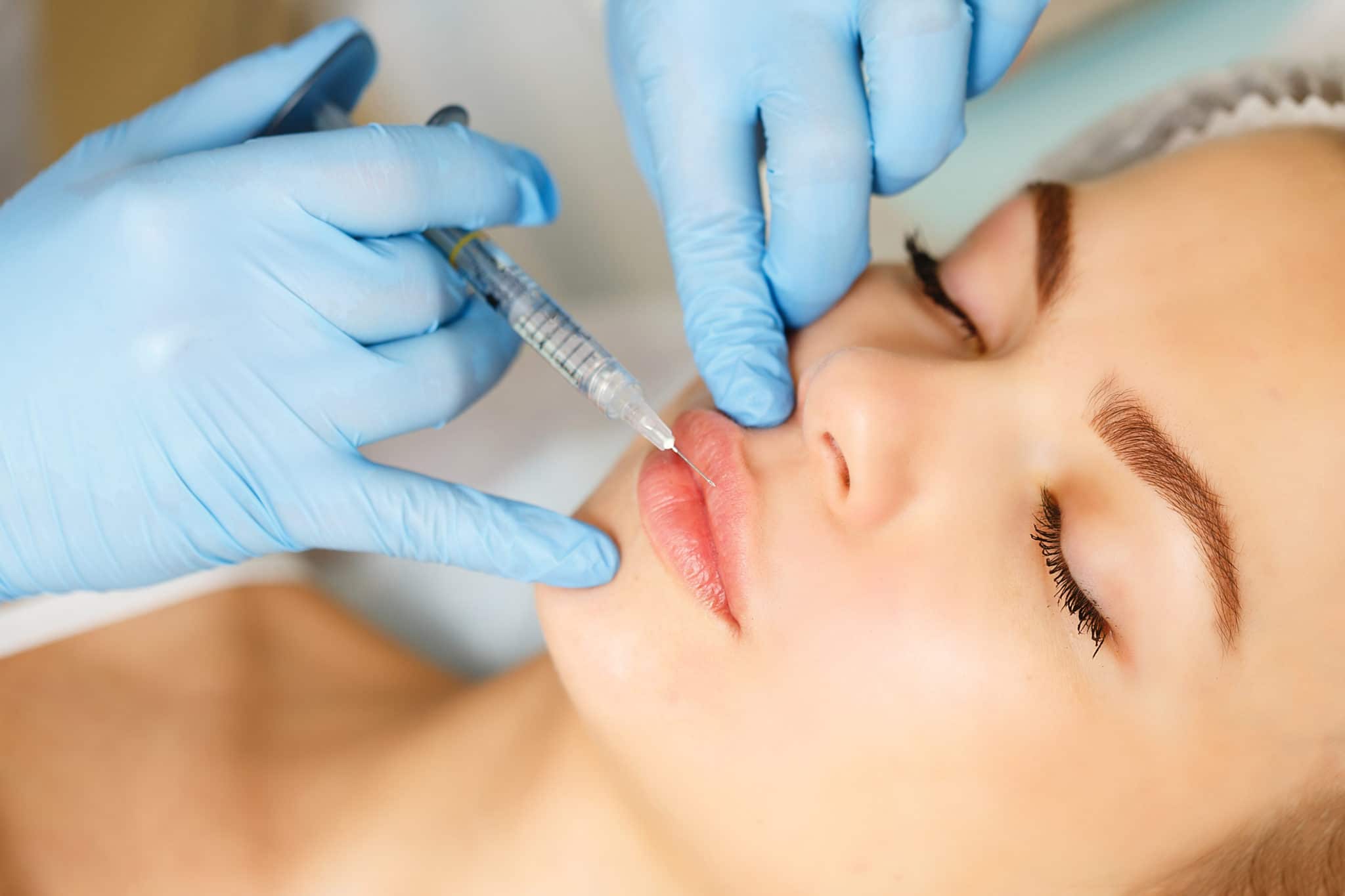 What To Know Before Getting Filler - Utah Facial Plastics
