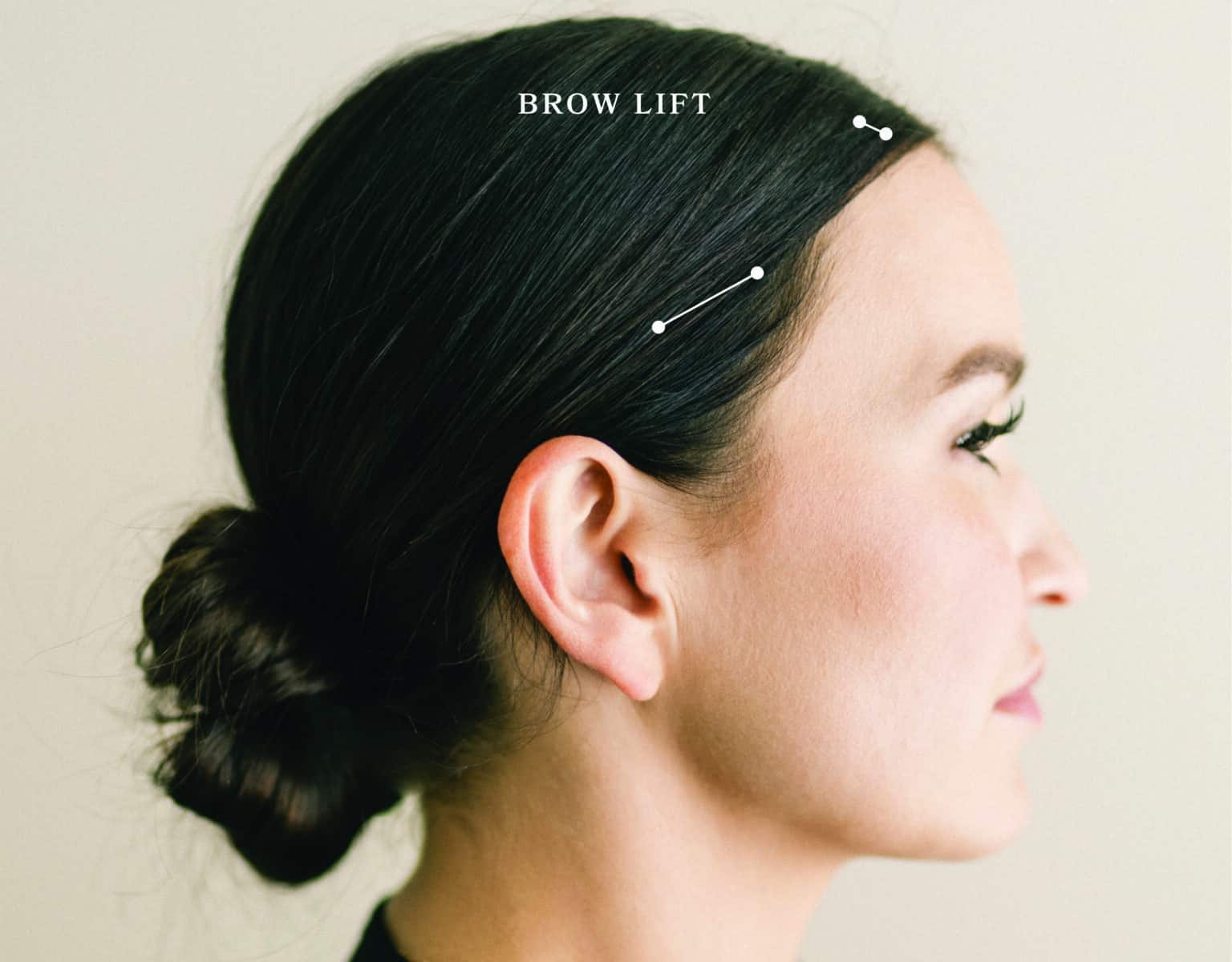 Forehead Lift Salt Lake City - Brow Lift in Utah