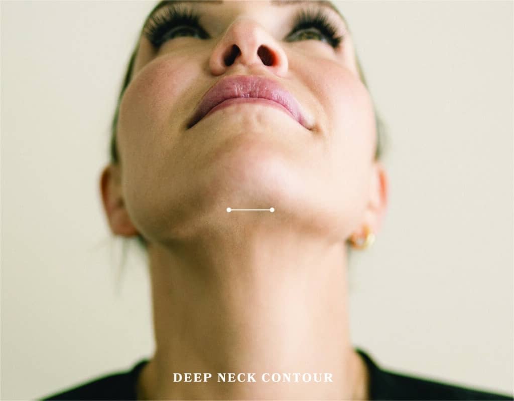 Direct Necklift Surgery | Neck & Chin Procedure | Utah Facial Plastics