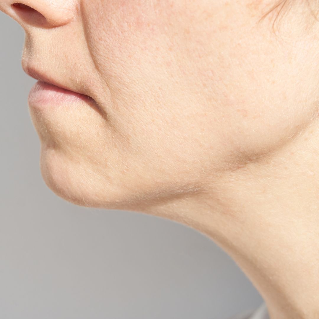 What is a Mini Neck Lift? - Utah Facial Plastics