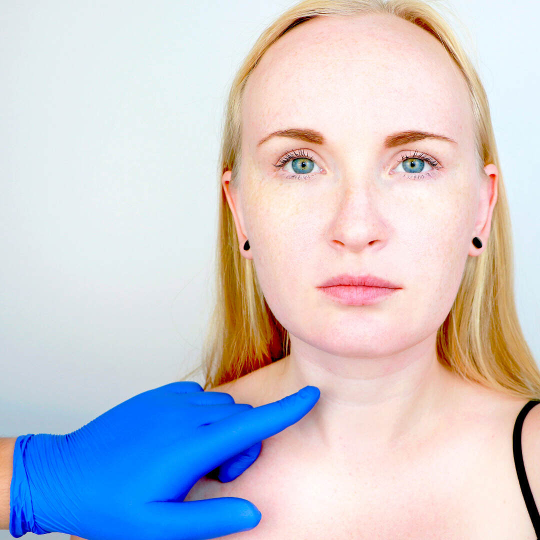 What Are Neck Tightening Treatments? Exploring Options and Benefits ...